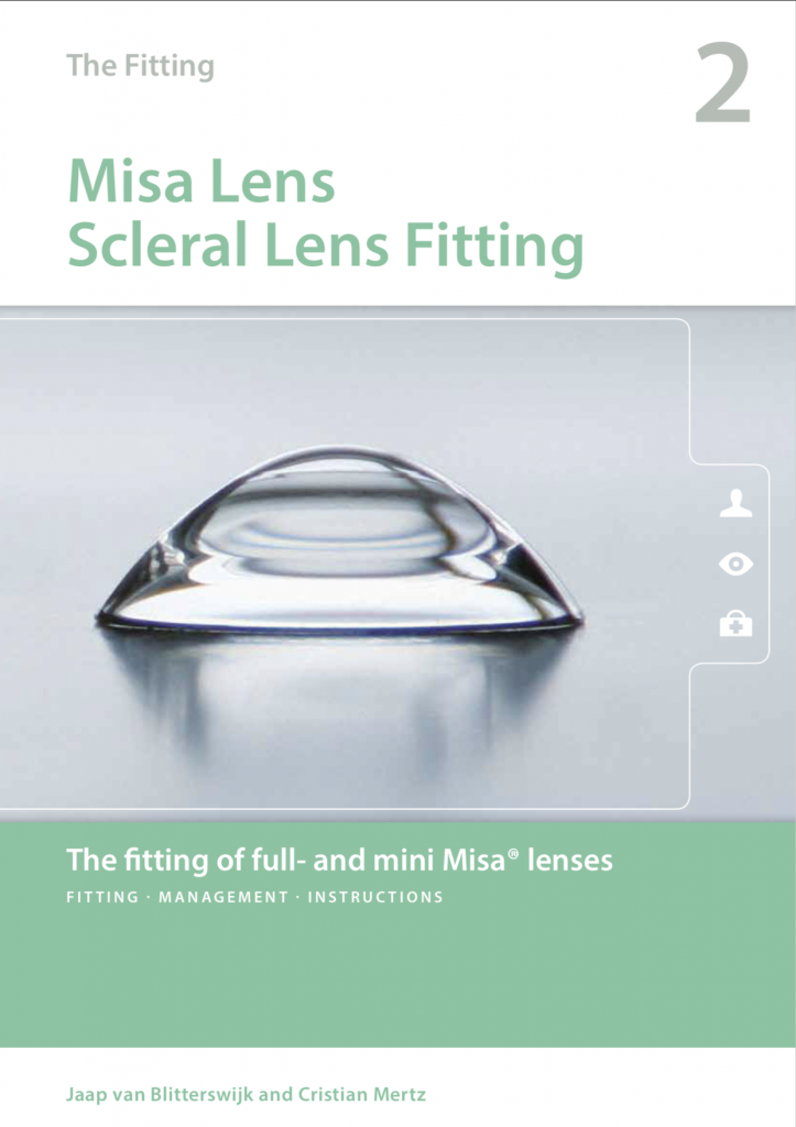 Scleral Lenses – Ophtecs Europe